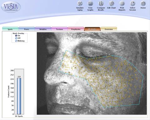 Visia - St.Petersburg, FL - Coundouriotis Facial & Plastic Surgery