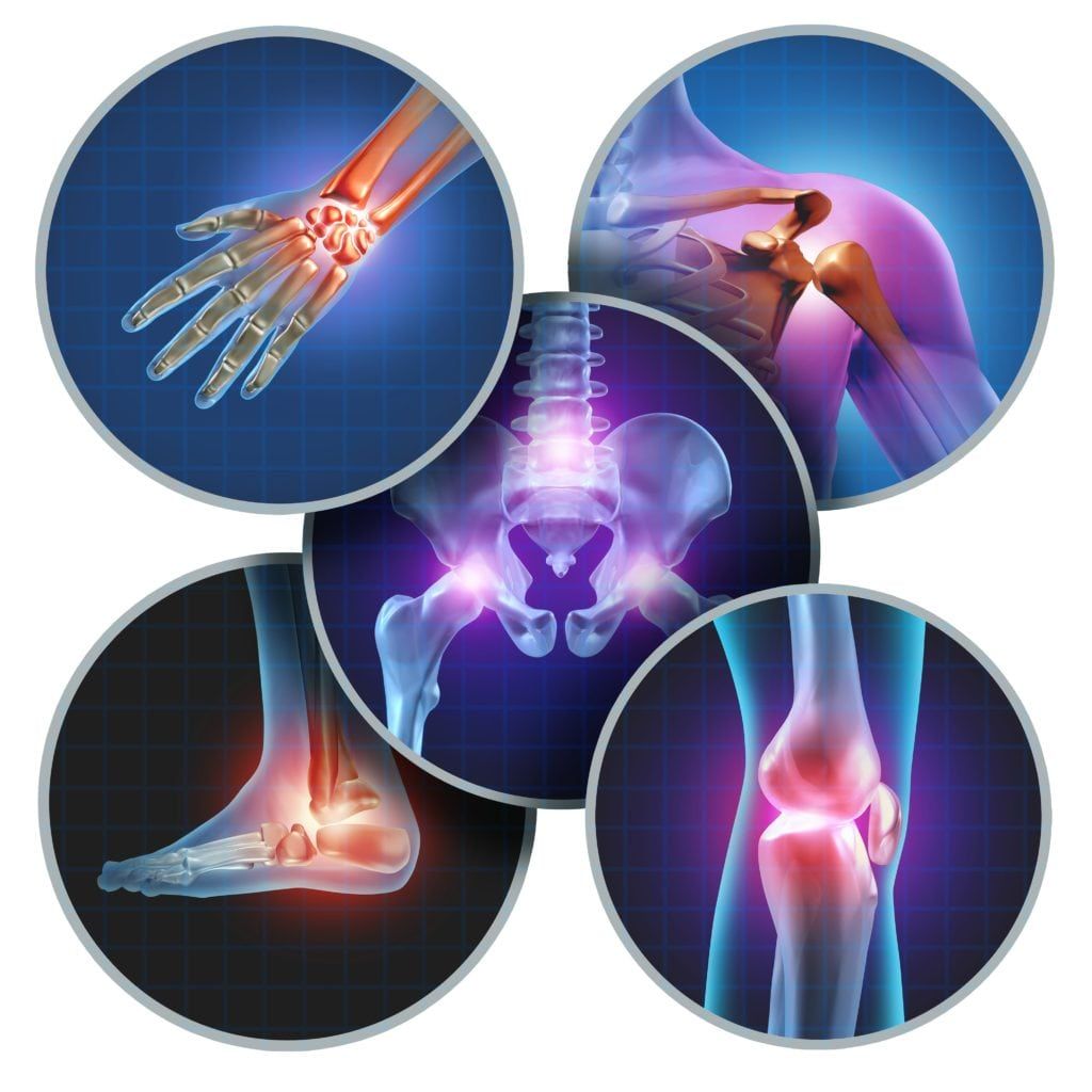 Preventing Arthritis