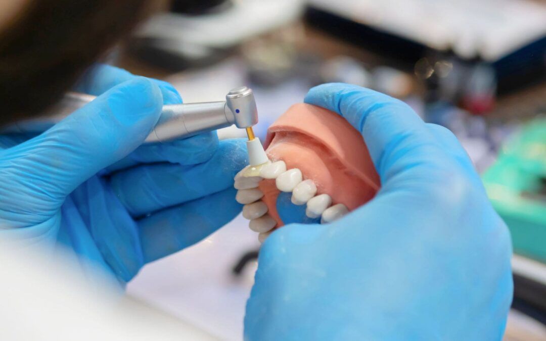 Direct vs. Indirect Restorations: What’s the Difference? » Santa Ana ...