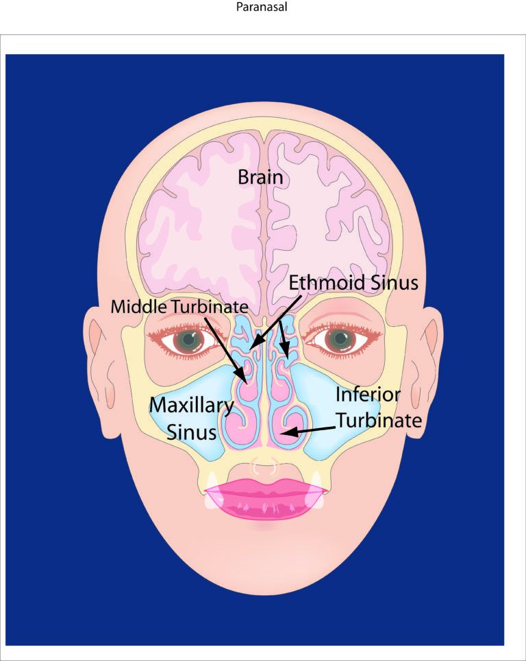 Acerca de sus pasajes nasales y sinusales - La Clínica de Rinosinusitis ...