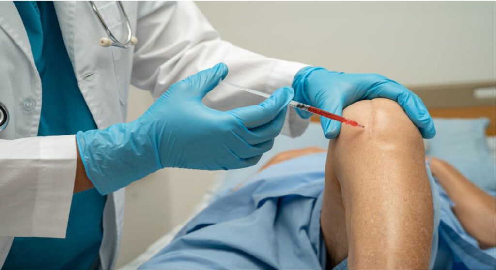 Plasma Rich Protein (PRP) Archives - Arthritis Care of TexasArthritis ...