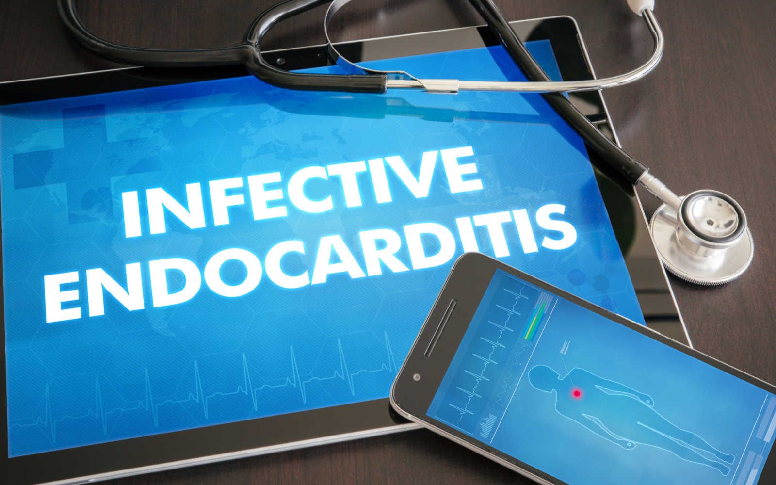 Infective Endocarditis and How Oral Hygiene Protects Us » Los Angeles ...