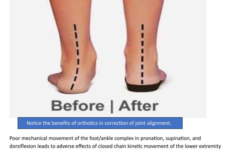 Closed Chain Kinetic Movement of the Lower Extremities - Barnes Foot ...